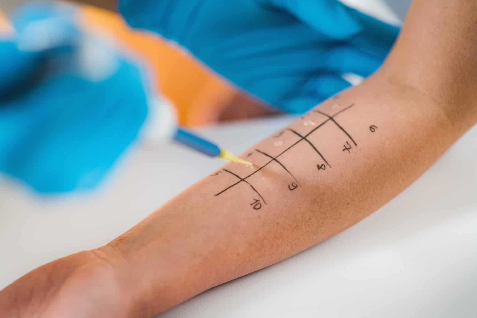 Allergologia a Mentana (Roma) | Poliambulatorio Scienza Medica